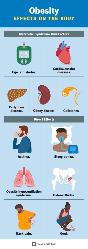 Water Weight Explained: Uncover Its Impact on Your Health! | Medicdrug